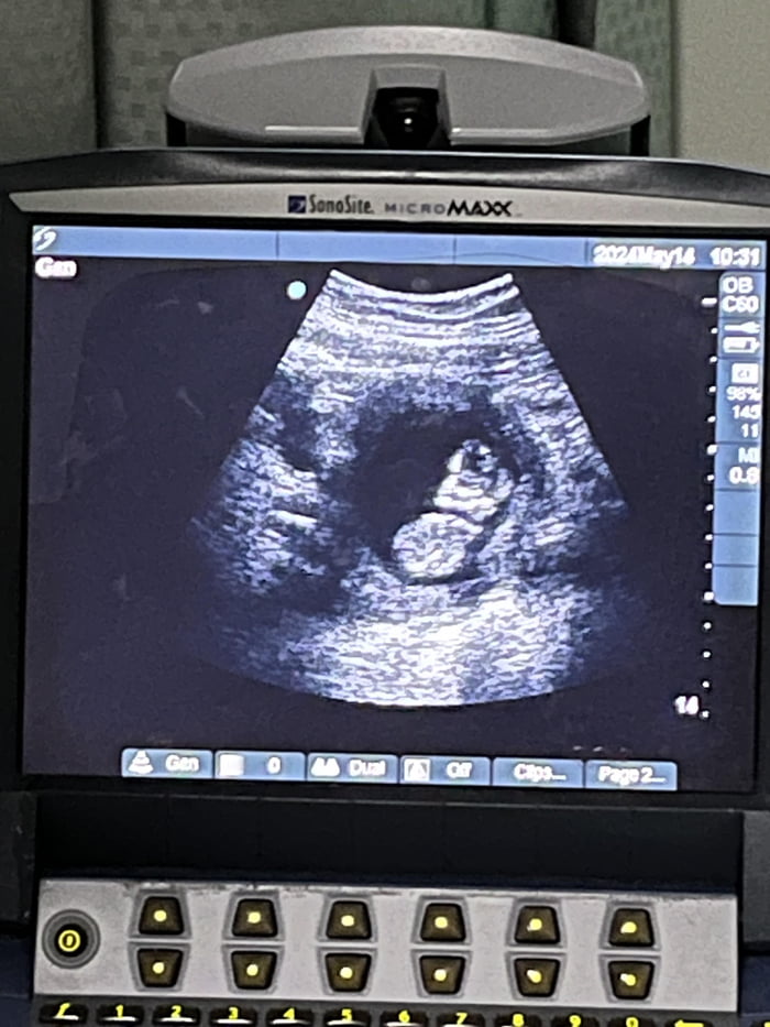 UPDATE: After nearly 18 years together, it finally happened!!! - 9GAG