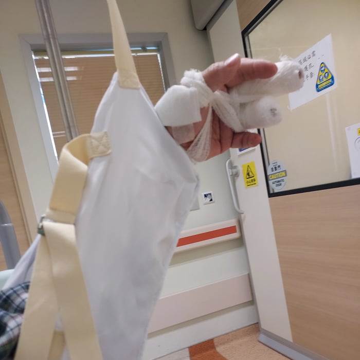 Holding my mauled middle finger. Goodbye 2024 - 9GAG