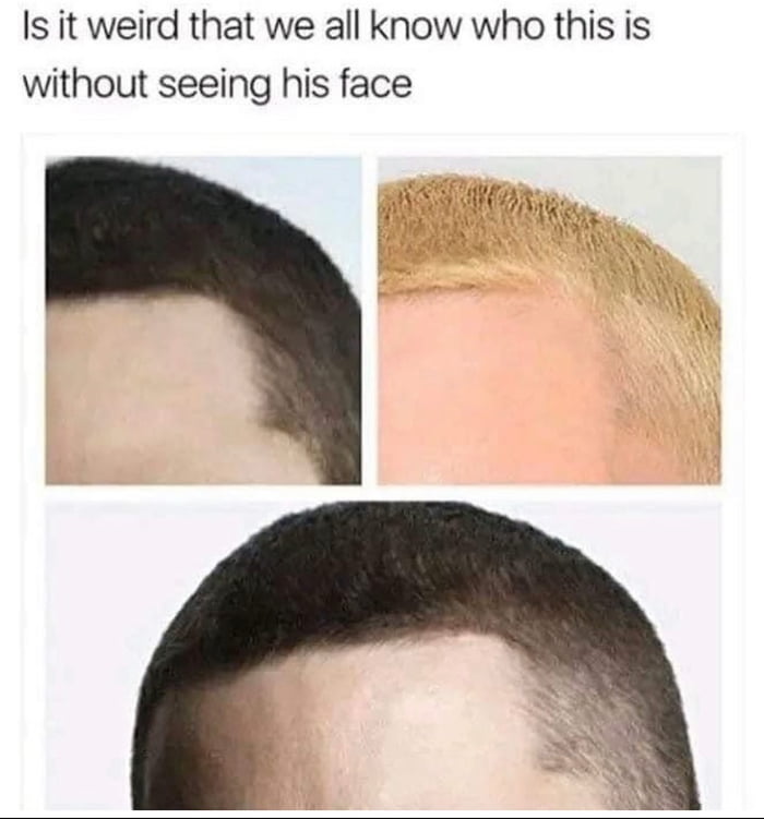 The forehead speaks volumes. - 9GAG