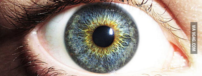 My eye, another Wilson's disease - but it's somehow nice. - 9GAG