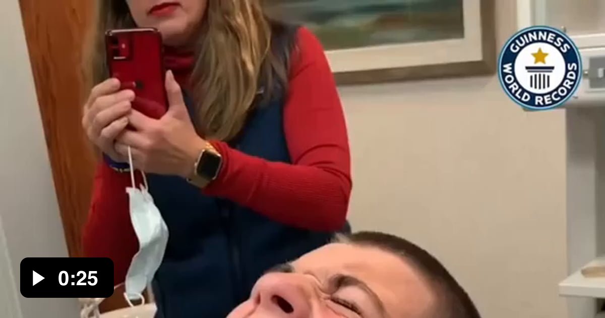 World record of having widest mouth gape(Male) - 9GAG