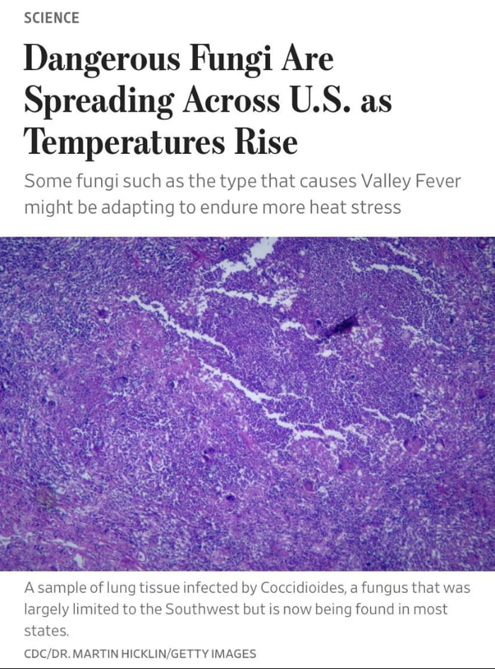 Dramatic pause......we lose - 9GAG