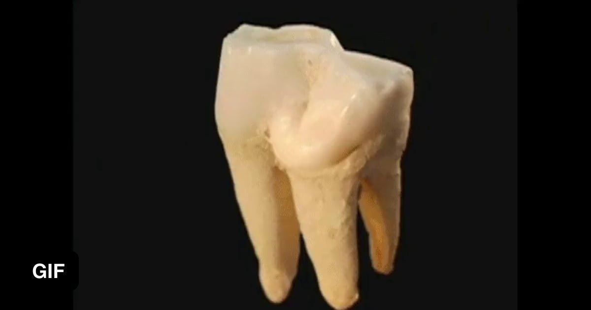 Tooth magnified - 9GAG