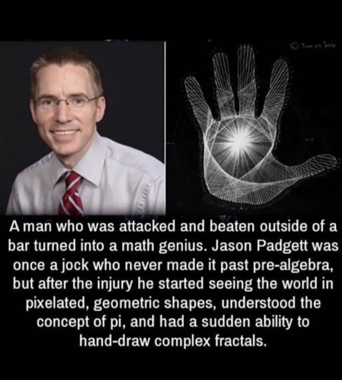 How 1 Man’s Brain Injury Turned Him Into A Math Savant - 9GAG