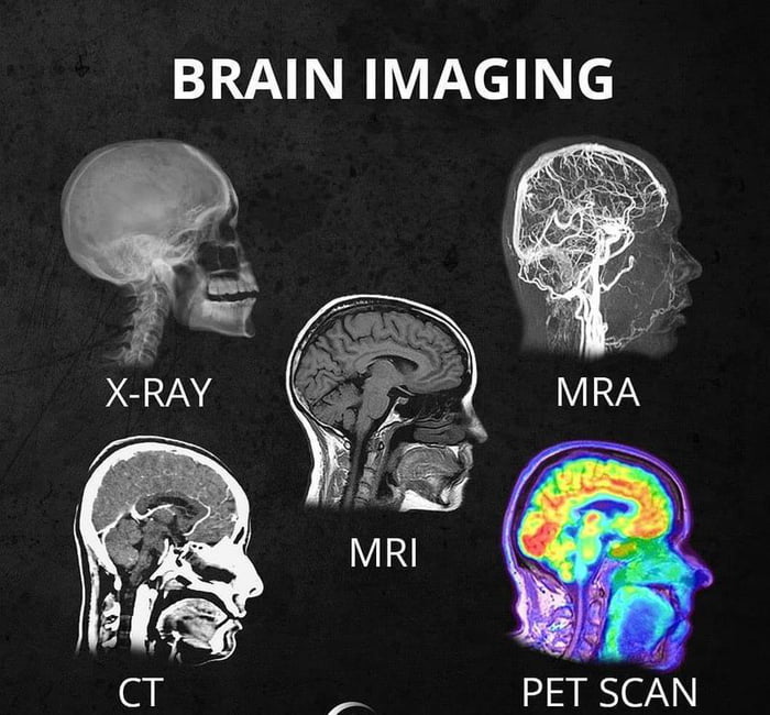 Differment type of brain images - 9GAG