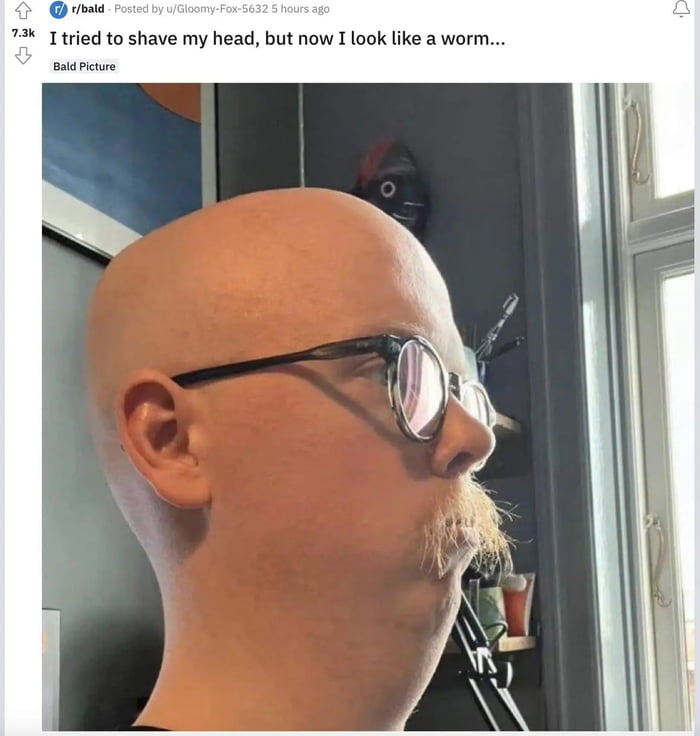 I think he has bigger problems than being bald - 9GAG