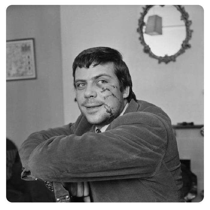 Oliver Reed after a pub brawl, 1964 - 9GAG