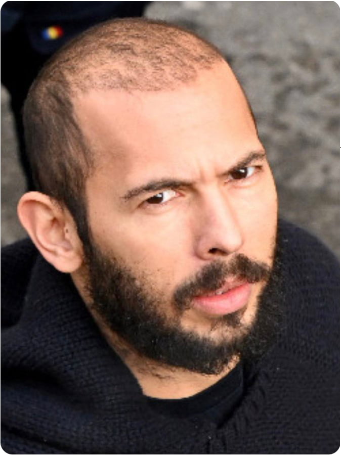 Andrew Tate insists he is bald by choice - 9GAG