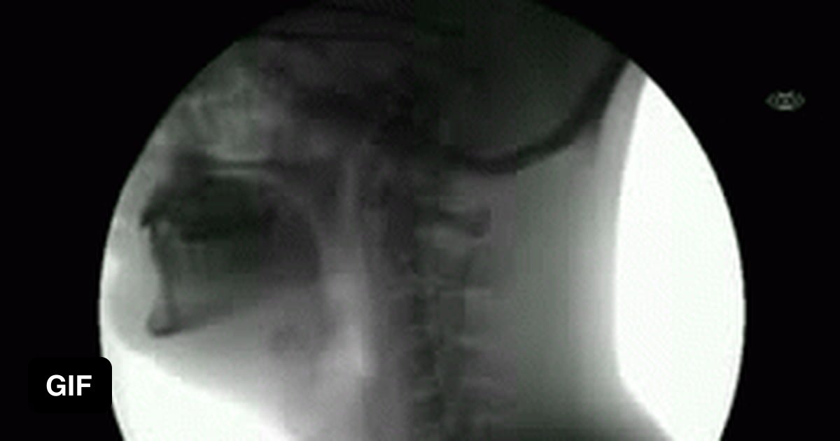 X-ray of chewing and swallowing food - 9GAG
