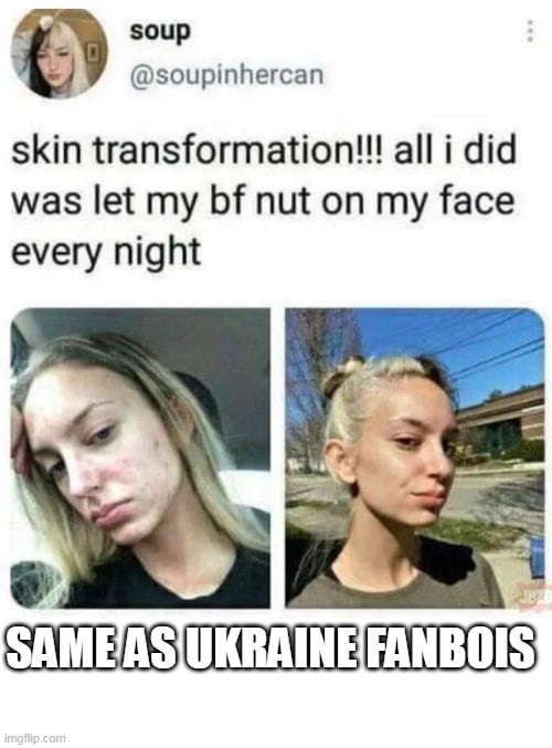 Ukraine Fanboi Advice for Complexion - 9GAG