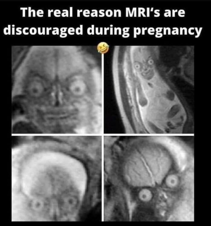 MRI of a pregnant woman - 9GAG