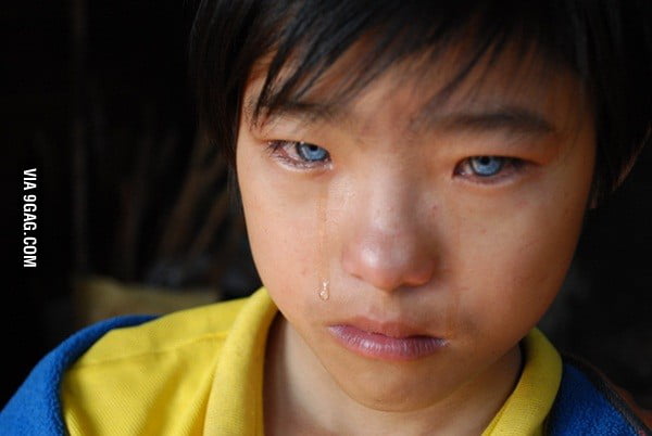 Vietnamese boy with mutant eyes. - 9GAG