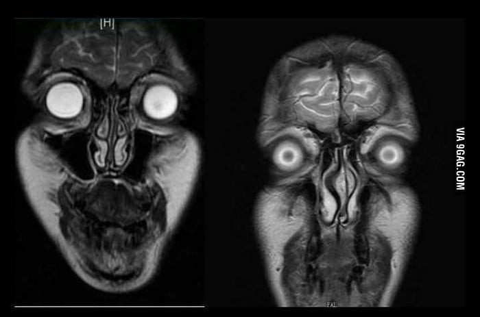 MRI scan of a human face. - 9GAG