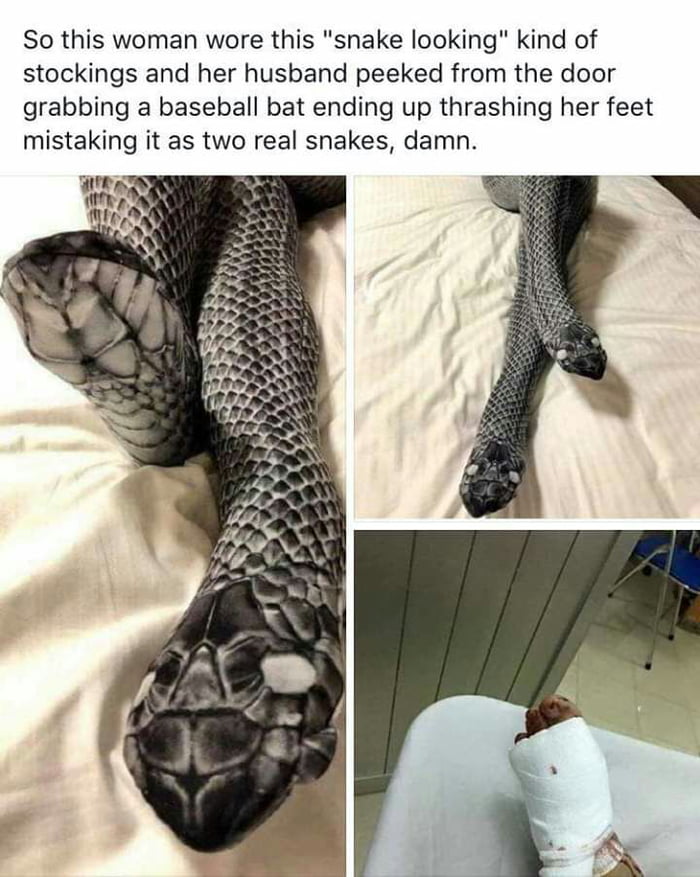 Snakey Legs - 9GAG