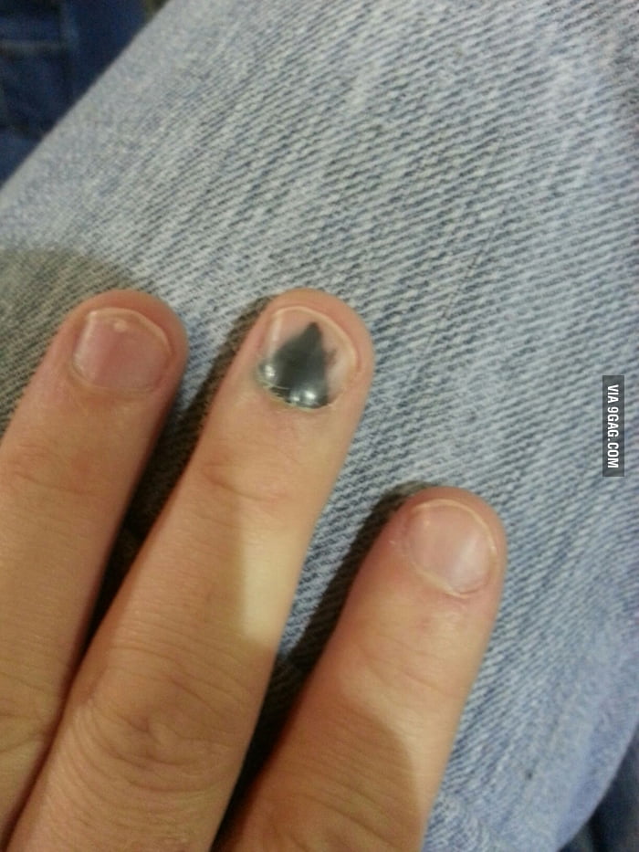 Smashed finger at work. Illuminati set in... - 9GAG