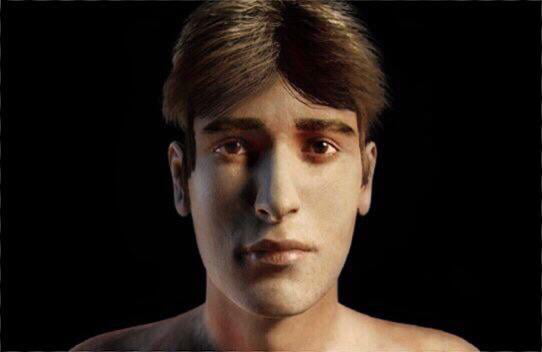 A proposed reconstruction of Joseph Merrick, the “Elephant Man ...