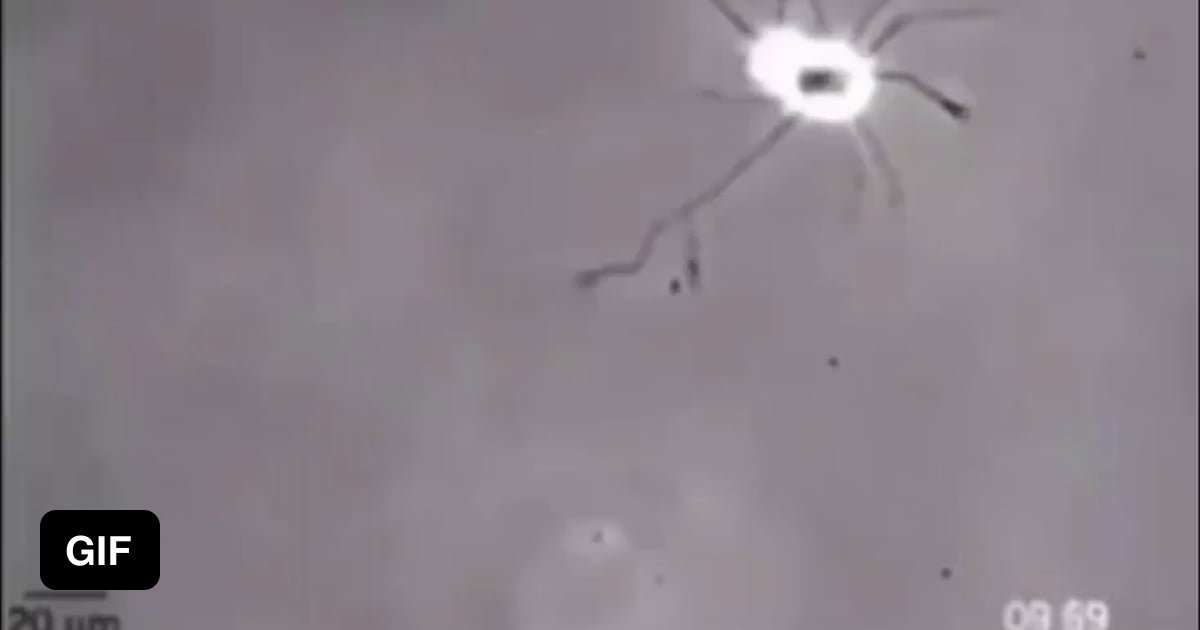 Single Brain Cell Looking for Connections - 9GAG