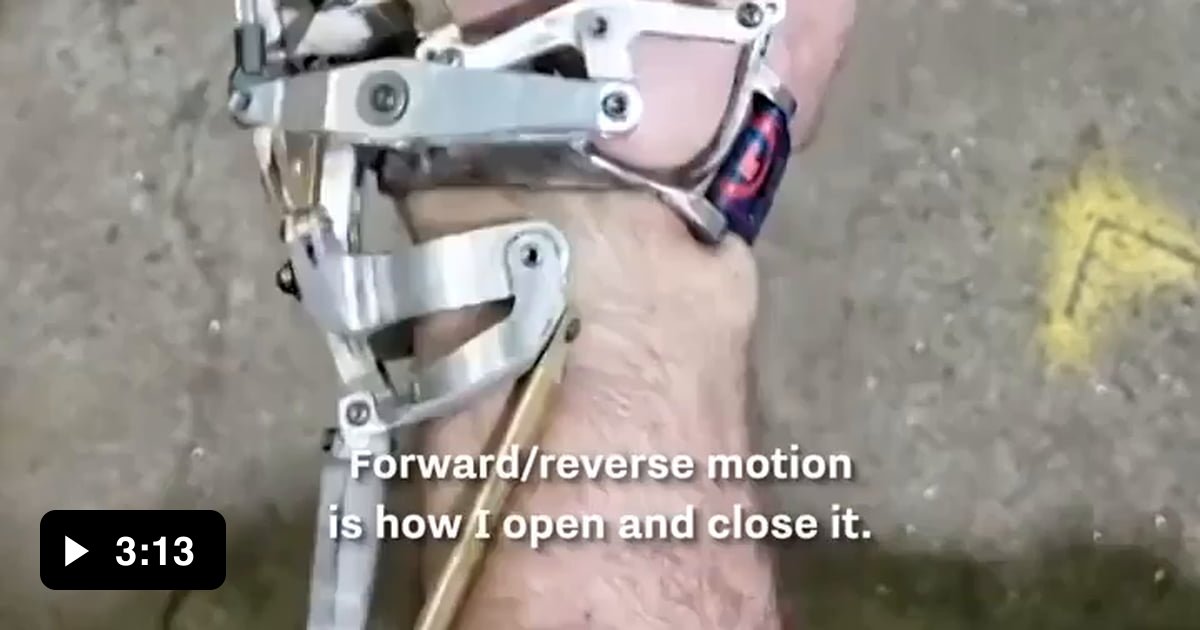 Engineer, Ian Davis lost 4 fingers in a work accident so he built ...