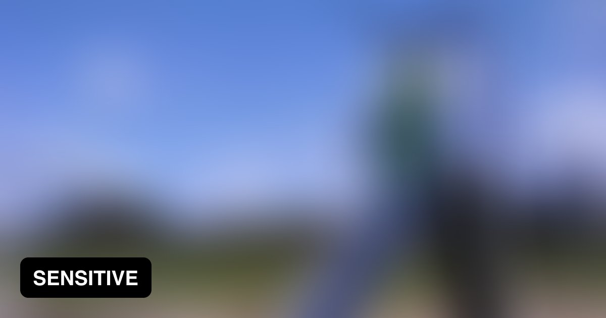 That summer slide burn hits different - 9GAG