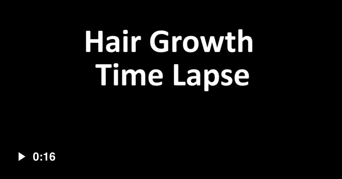 Hair growth time lapse - 9GAG