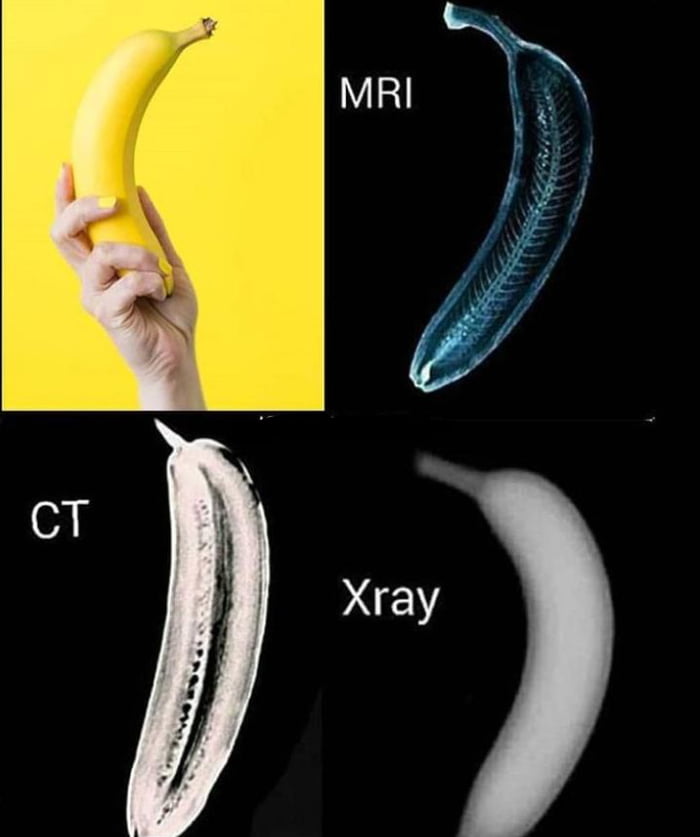 Visual differences in imaging modalities of banana - 9GAG