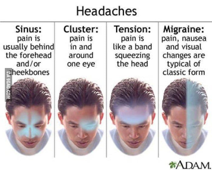 Ever wondered the types of headaches? - 9GAG