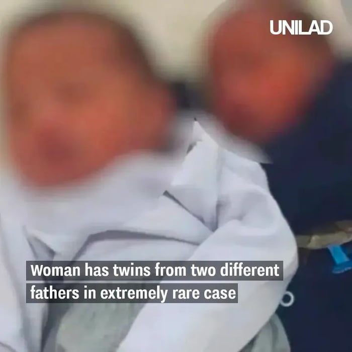 It's believed to be only the 20th case in history and requires very specific circumstances - 9GAG