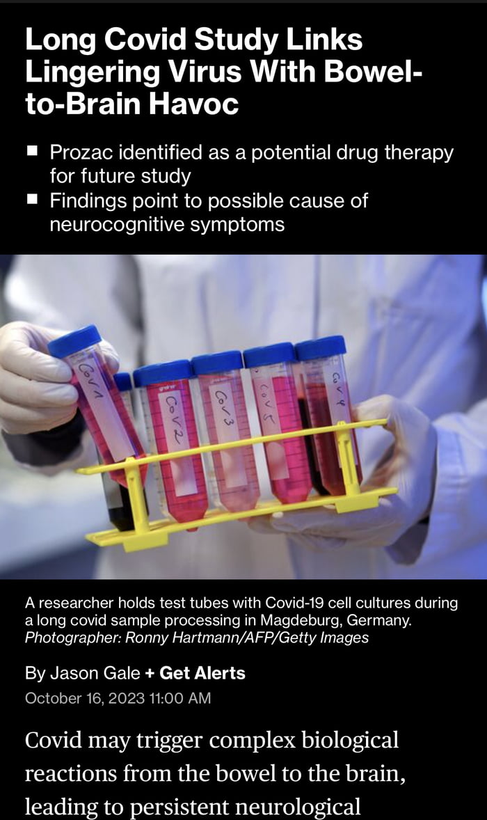 Scientist make progress understanding right wing logic - 9GAG