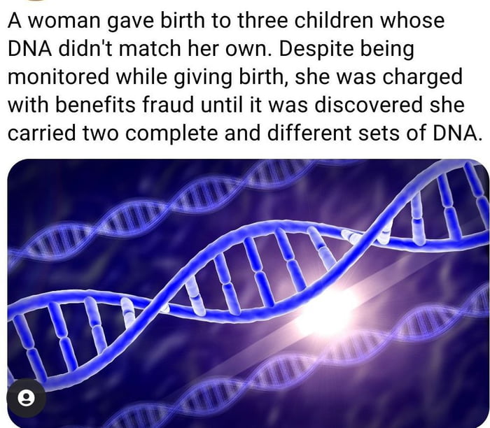 She absorbed a twin and became a chimera - 9GAG