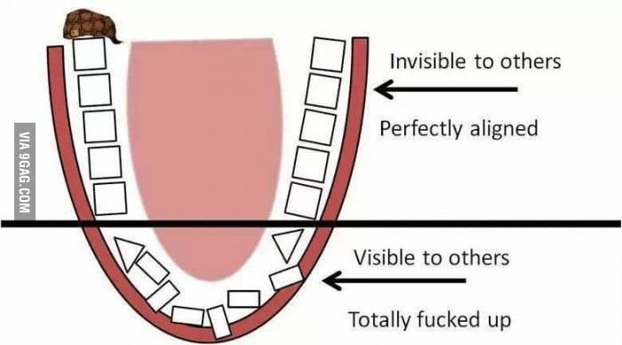 Scumbag teeth - 9GAG