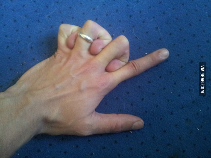 Anyone else with hyper-mobility? - 9GAG