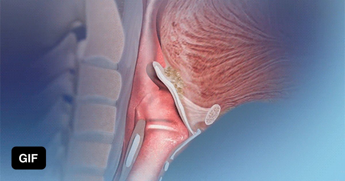 The Epiglottis, a flap of cartilage that seals off the windpipe while ...