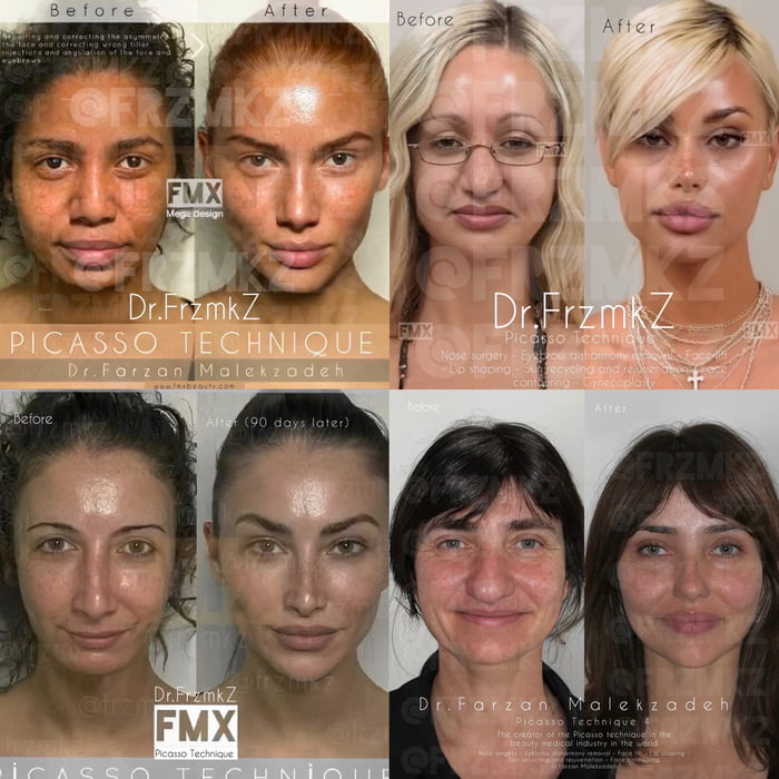 When you are a surgeon and you have the “Picasso Technique:” - 9GAG