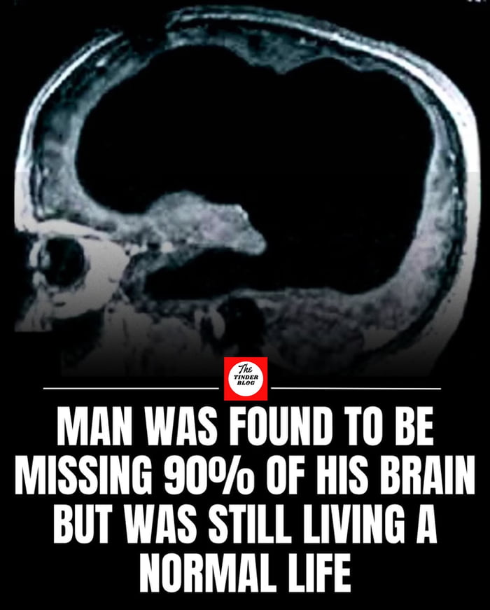 The brain is more resilient than we thought. - 9GAG