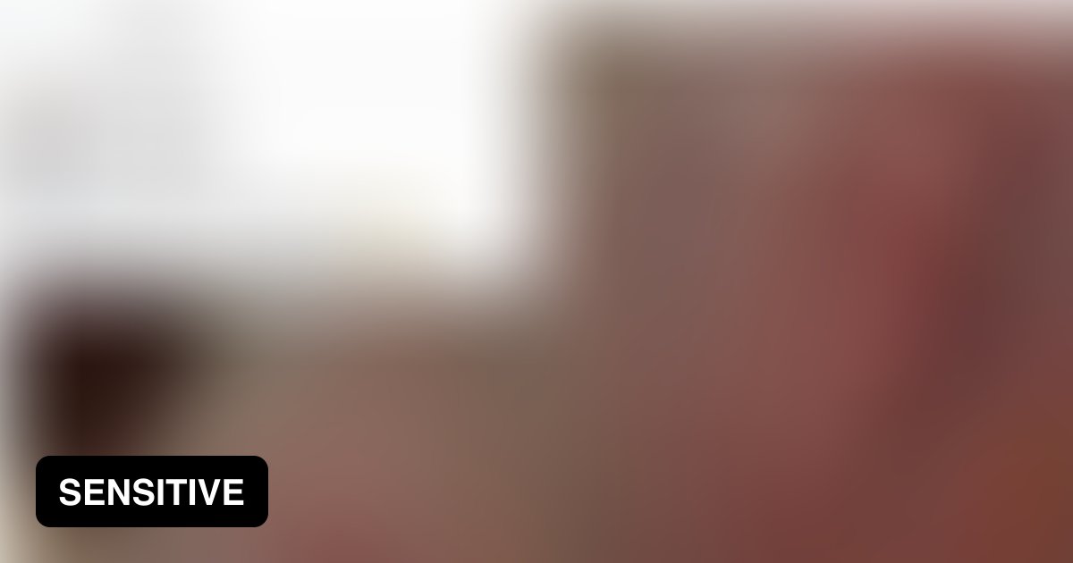 That's quite a love bite. - 9GAG