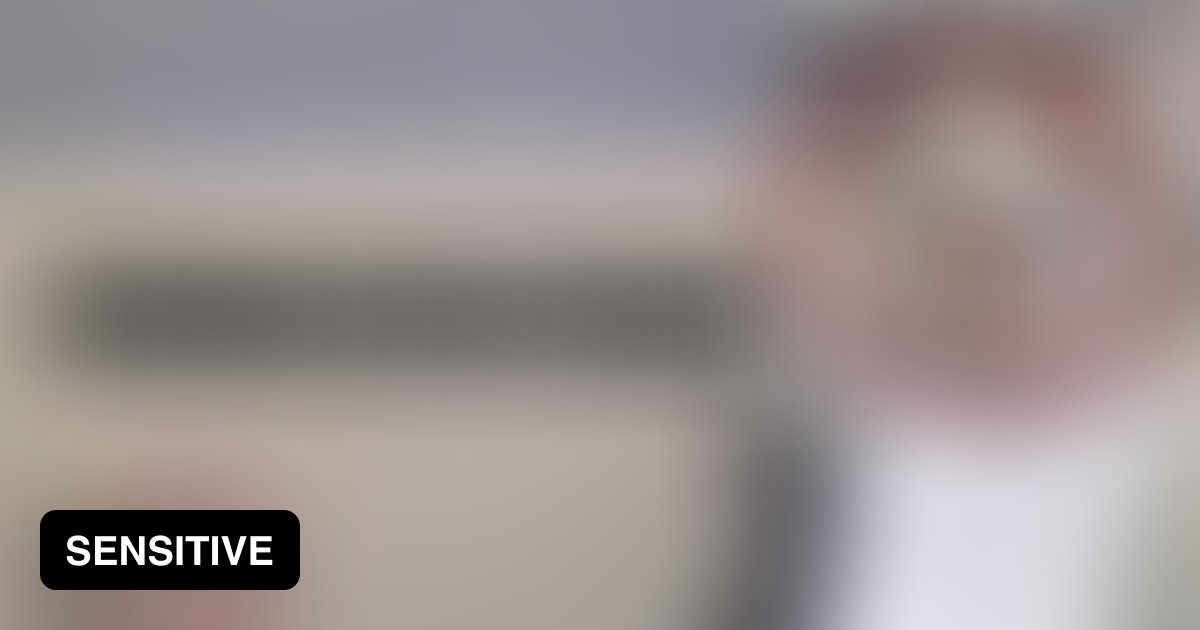 Dude got shot in the eye. - 9GAG