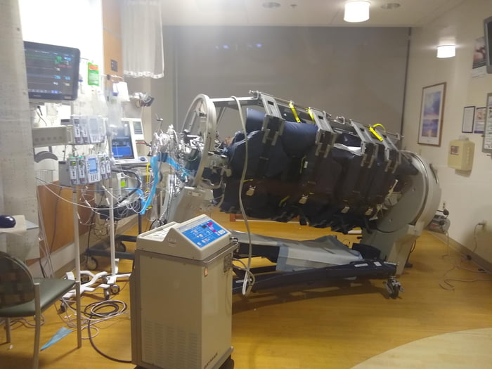 COVID patient receiving therapy in a rotoprone bed - 9GAG