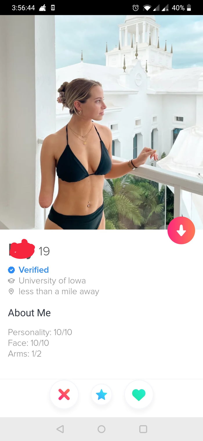 Ooh, self - burn! those are rare! - 9GAG