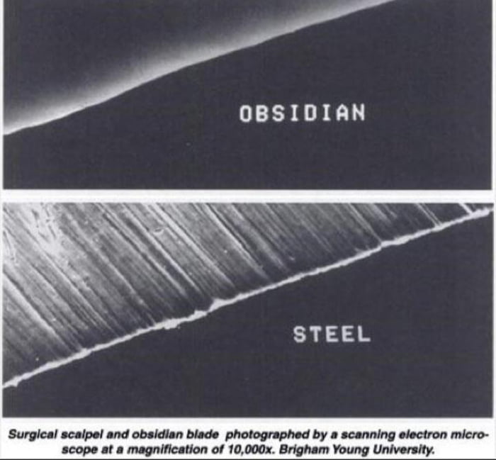 Steel Vs Obsidian Surgical Blades Under An Electric Scanning Microscope Steel Vs Obsidian Surgical Blades Under An Electric Scanning Microscope