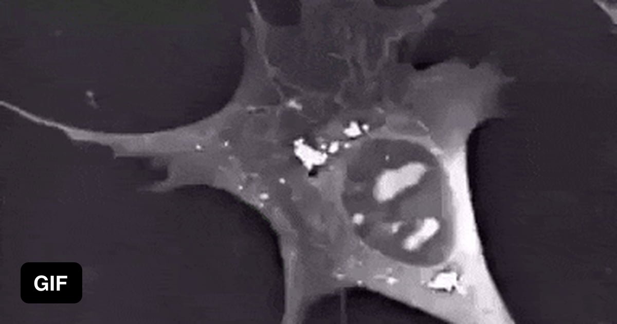 A dying neuron. - 9GAG