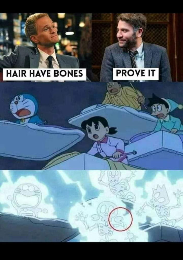 Hairs have bones.. - 9GAG