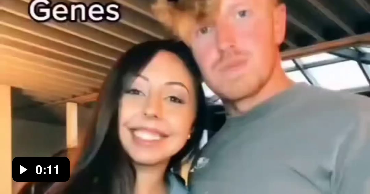 I think that's just albino of different kind - 9GAG