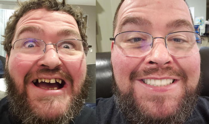 Shoutout to Boogie's new teeth, dosent even look like the same person ...