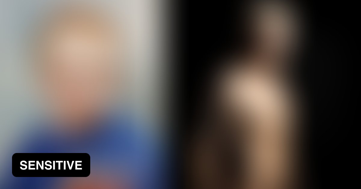 Jono Lancaster was given up for adoption because of his birth defect ...