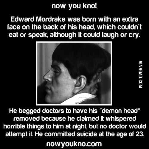Real life Two-Face - 9GAG