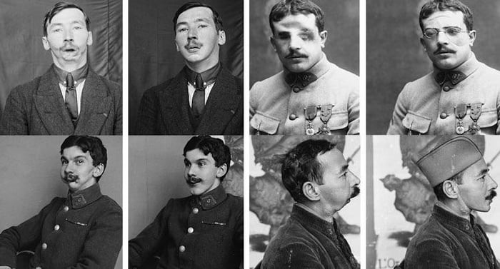 American sculptor Anna Coleman Ladd was one of many artists who used ...