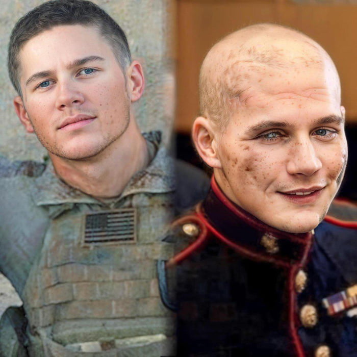 US Marine corporal William Kyle Carpenter, before and after he threw ...