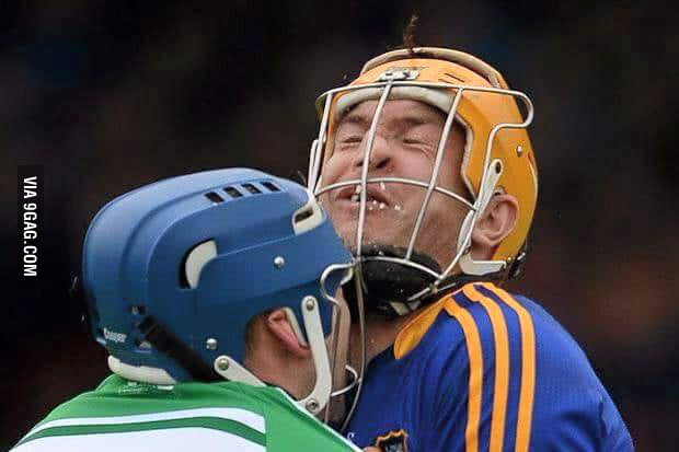 Big hit from game of Hurling. (yes those are his teeth) - 9GAG