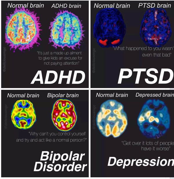 ADHD, PTSD, Bipolar and Depression - 9GAG