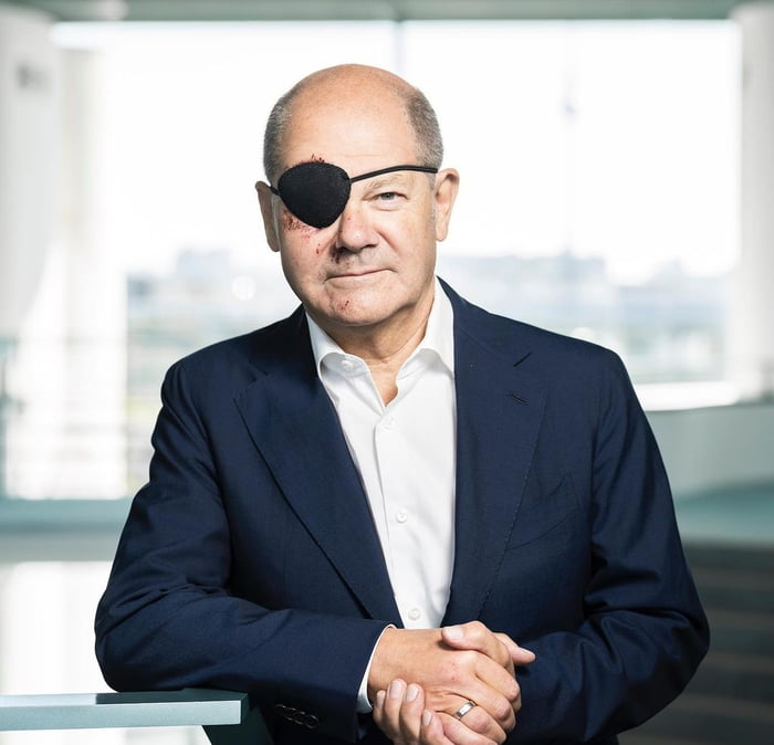 The German Chancellor fell and hurt his eye while jogging. Now he has ...